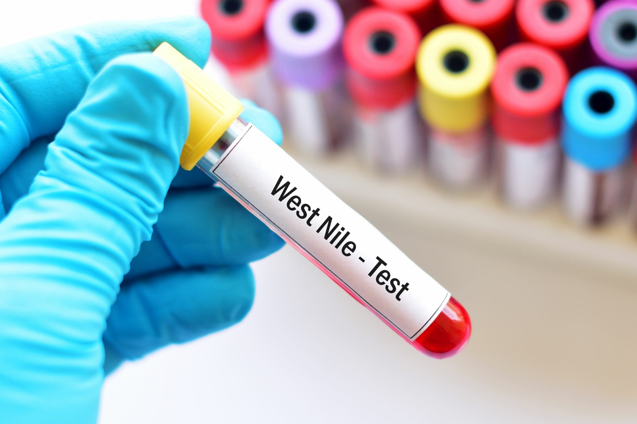 West Nile Virus Detected in Nine Mosquito Test Samples | LoveJustice